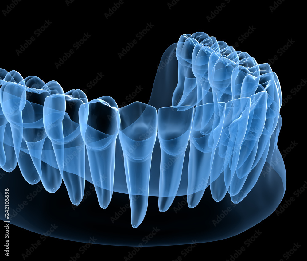 Dental Anatomy of mandibular human gum and teeth, x-ray view. Medically ...