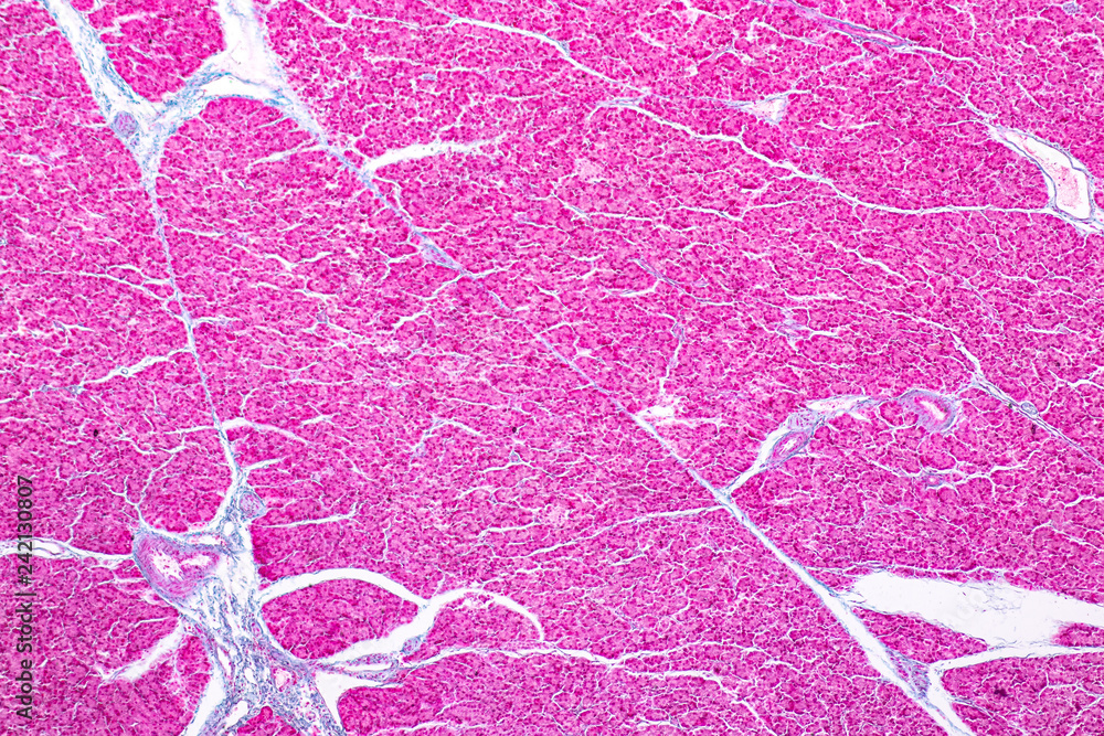 Tissue of pancreas is an organ of the digestive system and endocrine ...