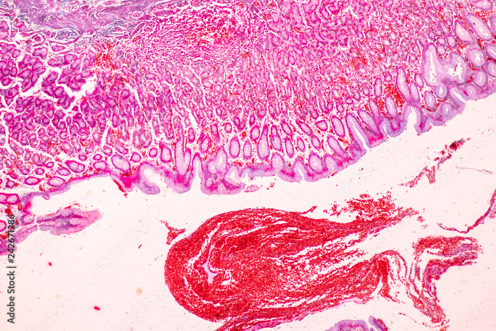 Tissue of Stomach under the microscopic, Physiology of the stomach for ...
