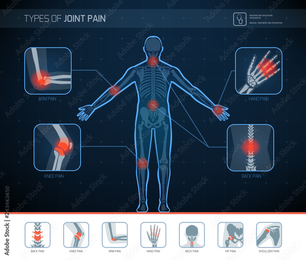 Types of joint pain infographic Stock Vector | Adobe Stock