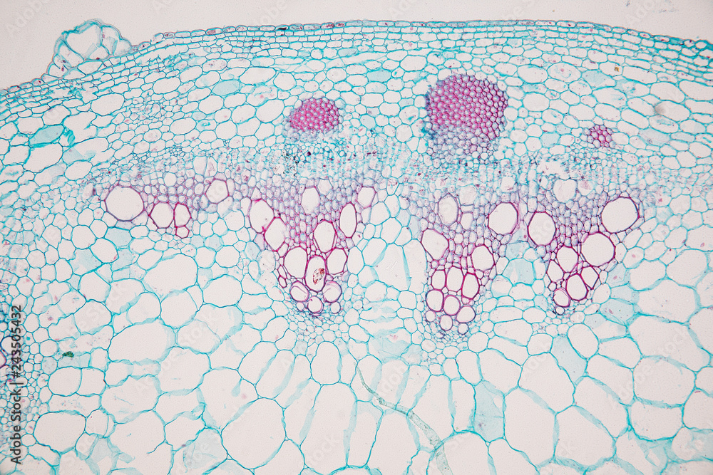 Cross-section Dicot, Monocot and Root of Plant Stem under the ...