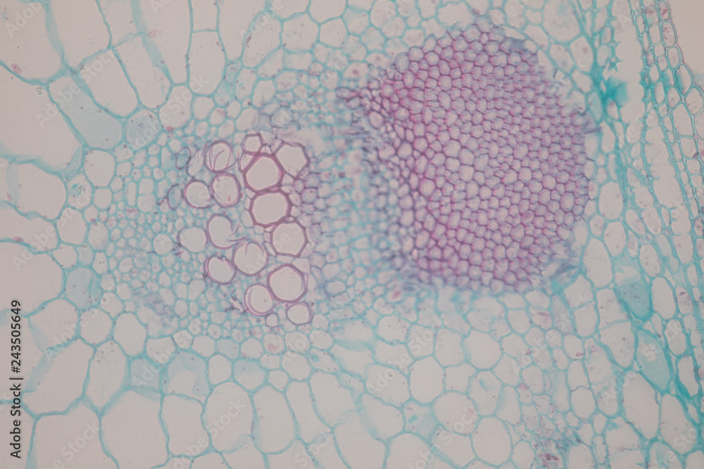 Cross-section Dicot, Monocot and Root of Plant Stem under the ...