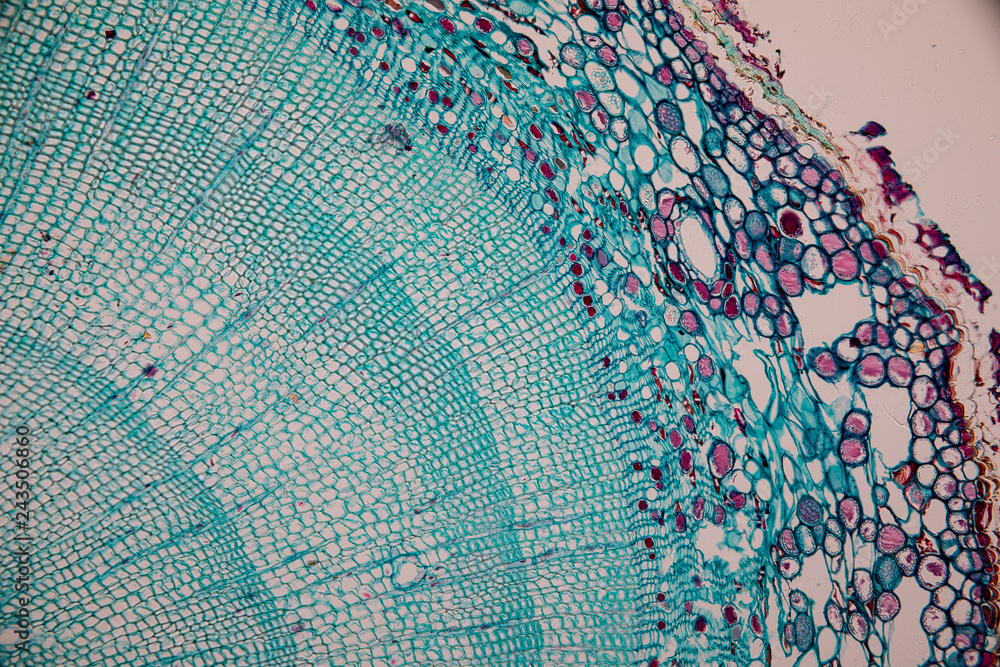 Cross-section Dicot, Monocot and Root of Plant Stem under the ...