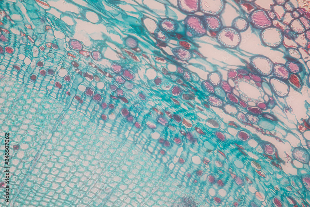 Cross-section Dicot, Monocot and Root of Plant Stem under the ...