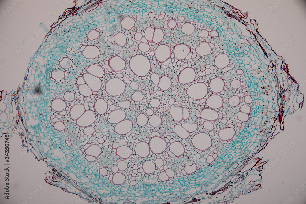 Cross-section Dicot, Monocot and Root of Plant Stem under the ...