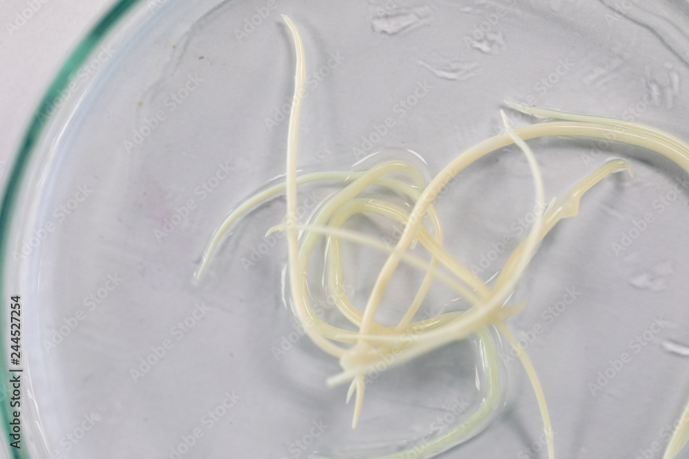 Ascariasis is a disease caused by the parasitic roundworm Ascaris ...