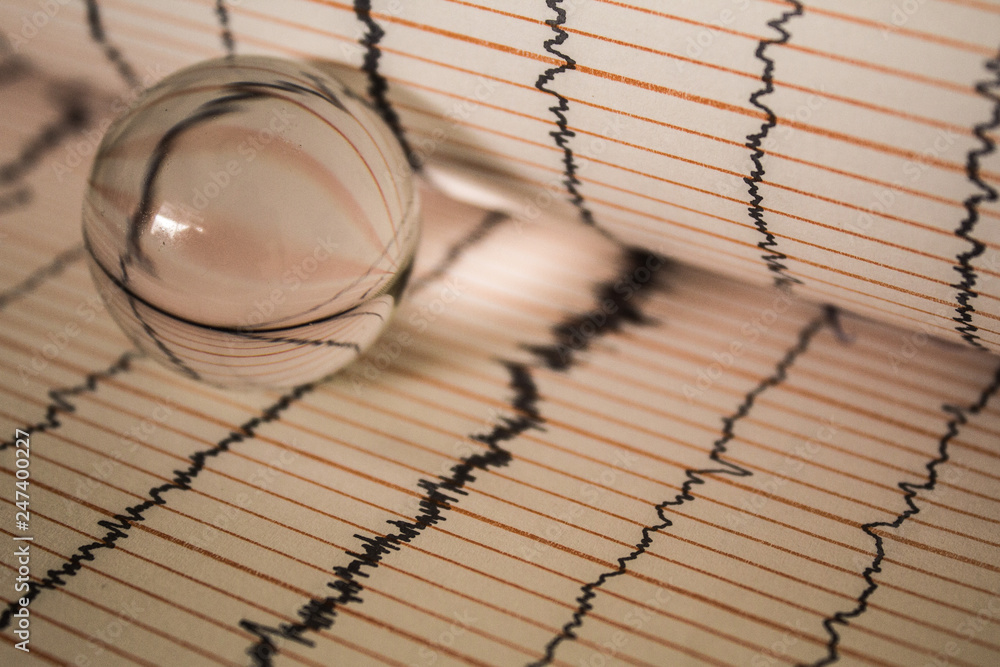 Stock-Foto „Sinus Heart Rhythm On Electrocardiogram Record Paper ...