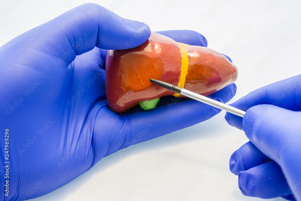 Doctor holds model of liver in hand, dressed in glove and with other ...