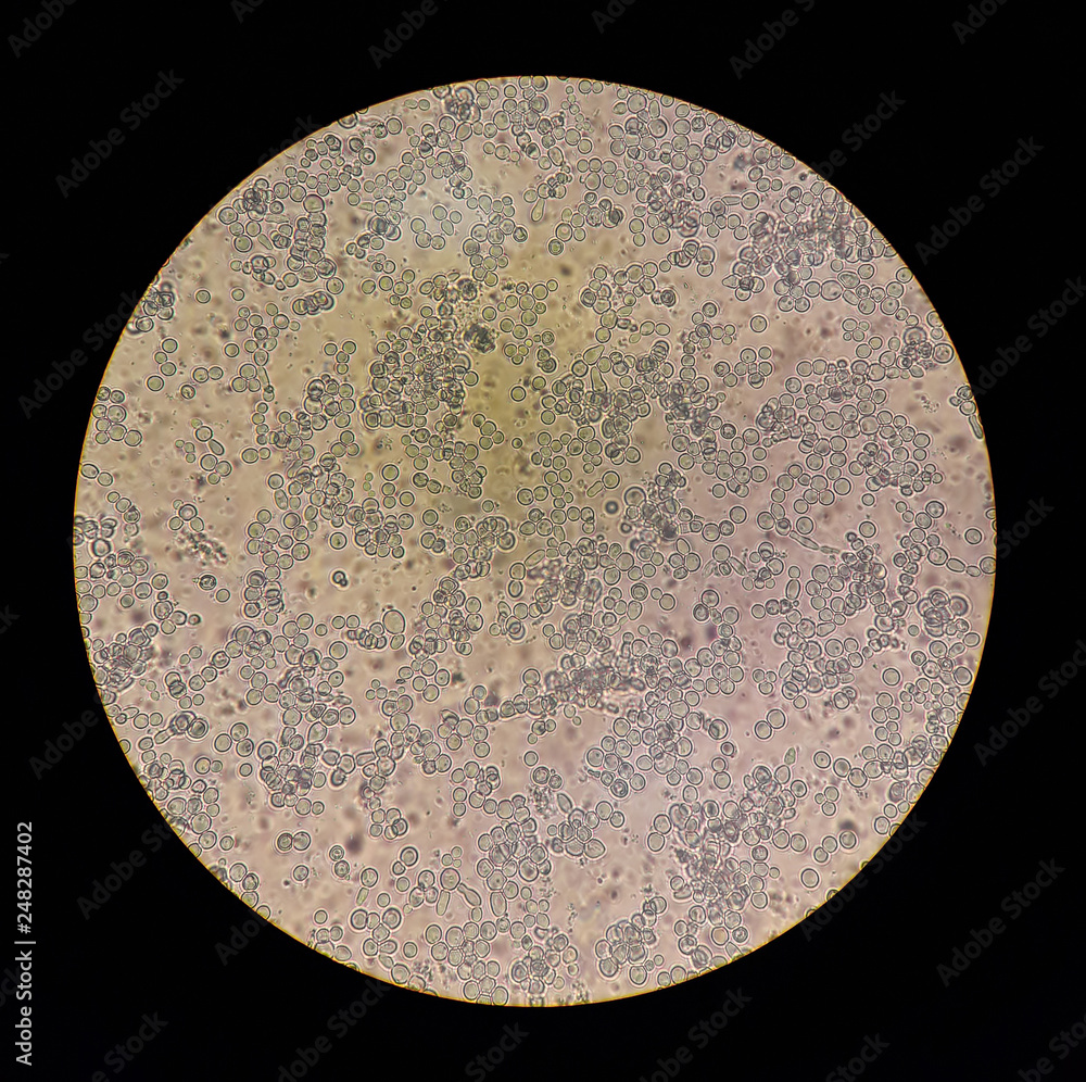 microscopic view of the fungi candida albicans Stock Photo | Adobe Stock