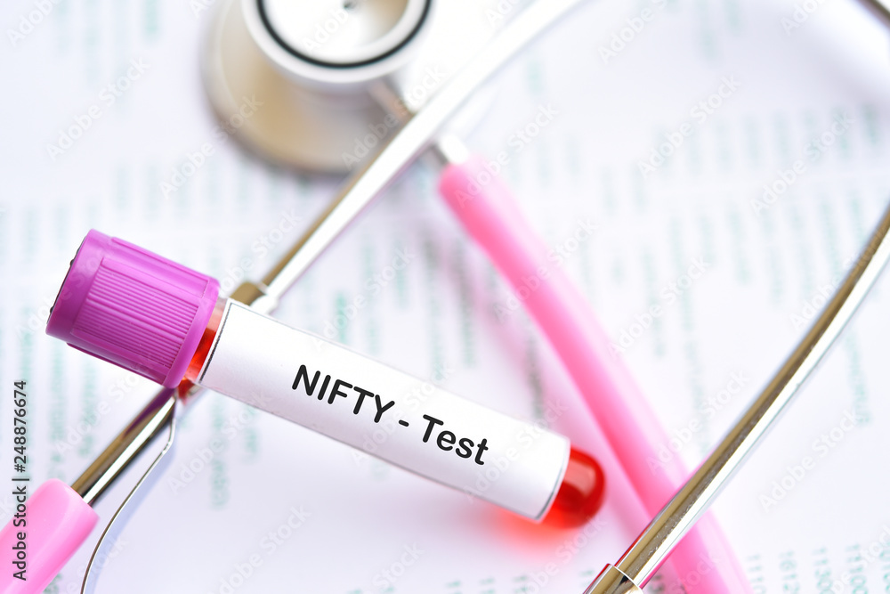 Blood sample for NIFTY or Non Invasive Fetal Trisomy test, diagnosis ...