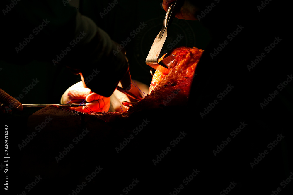 operation of an ear and abdomen in a surgery room of the university ...