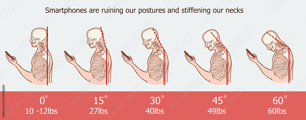 The bad smartphone postures,the angle of bending head related to the ...