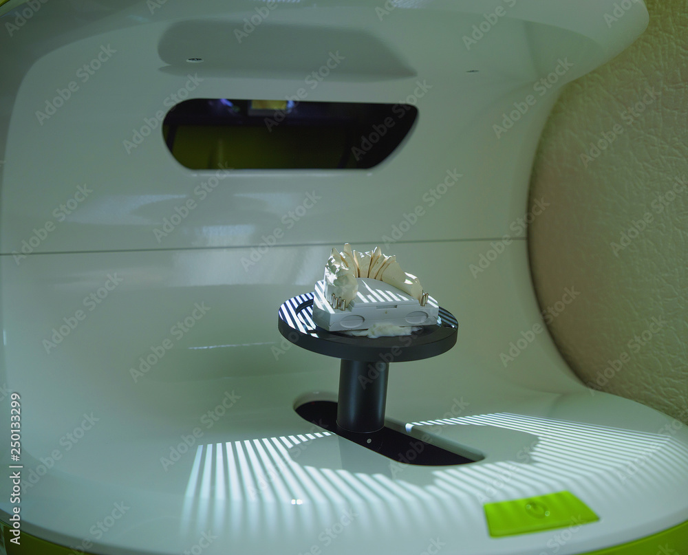 Specialized dental 3D scanner reads information from the plaster model ...