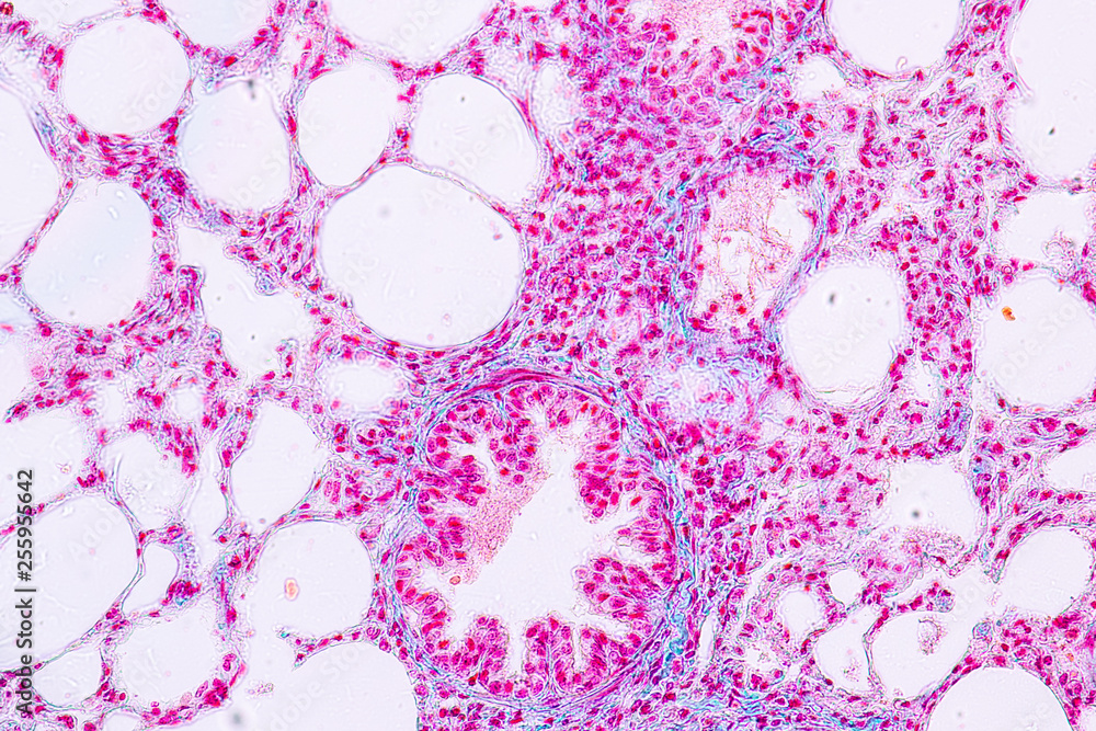 Concept of Education anatomy and Human lung tissue under microscope ...