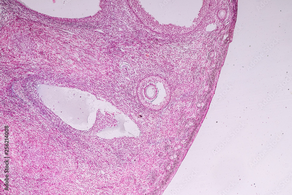 Education anatomy and Histological sample Ovary of rabbit Tissue under ...