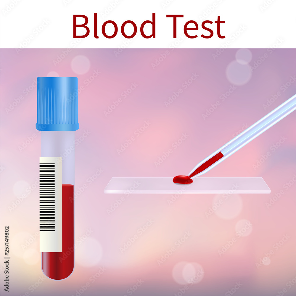 Blood test. Vector medical illustration. Droplet, capillary, tube ...