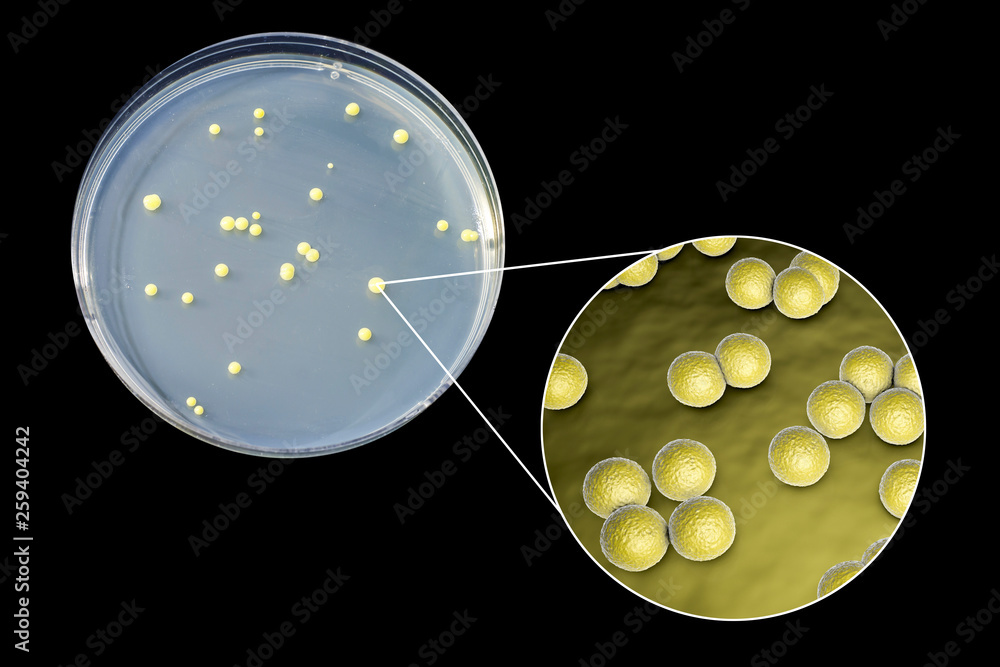 Colonies of Micrococcus luteus bacteria on agar plate and close up view ...