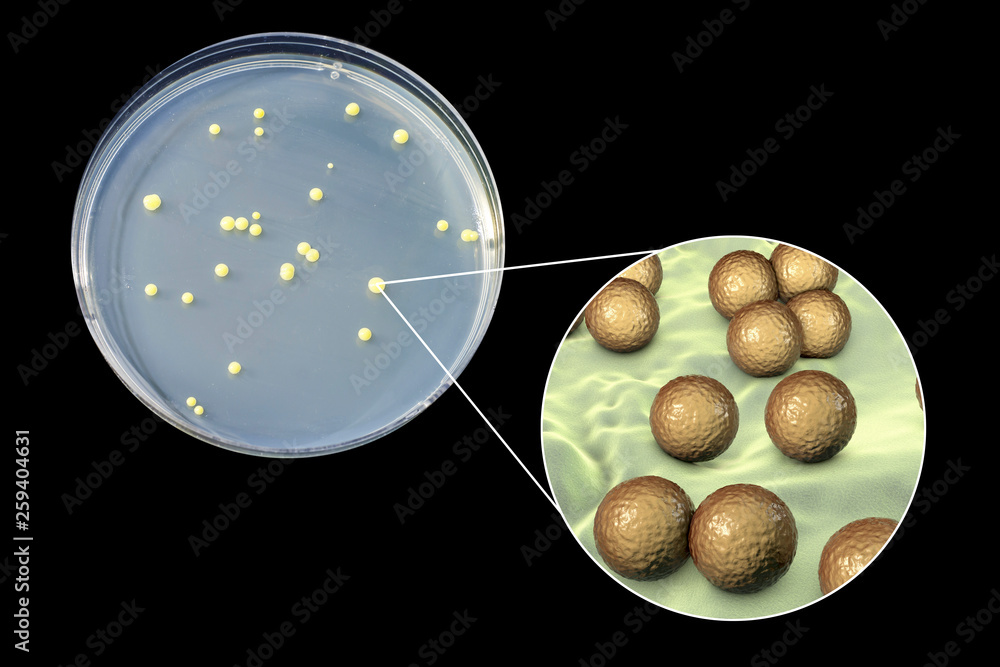Colonies of Micrococcus luteus bacteria on agar plate and close up view ...