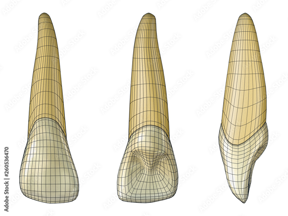 maxillary lateral incisor tooth in the vestibular, palatal and lateral ...