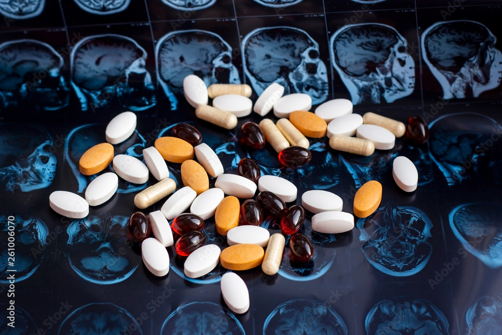 Different pharmaceutical medicine pills on magnetic brain resonance ...