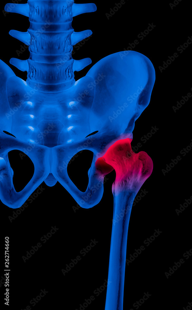 Стоковое фото «X-ray of lower half length human skeleton anterior view ...