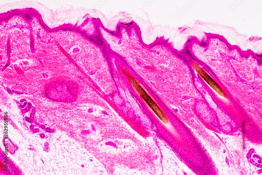 Education anatomy and physiology of Human scalp show of hair folticles ...