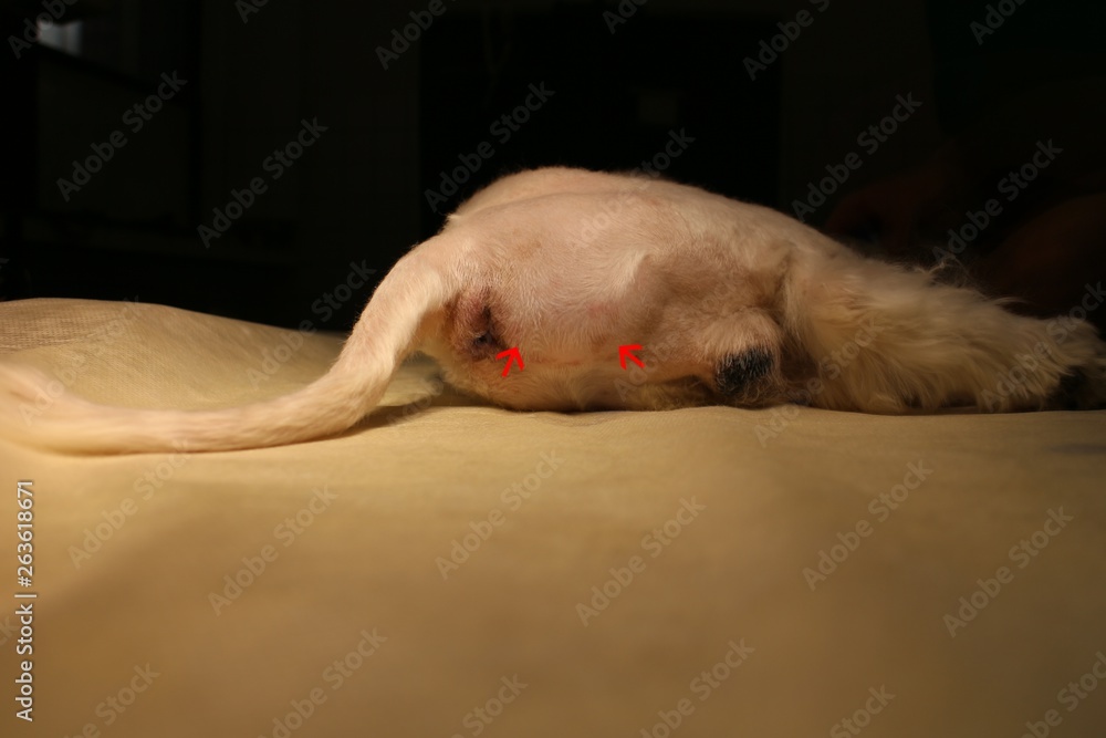 Inguinal hernia (protrusion of abdominal-cavity contents through the ...