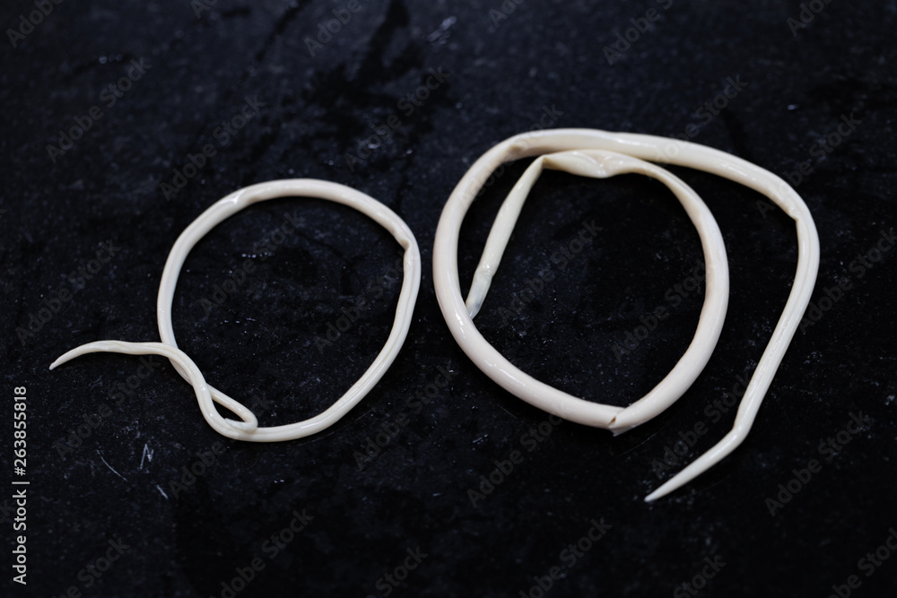 Ascariasis is a disease caused by the parasitic roundworm Ascaris ...