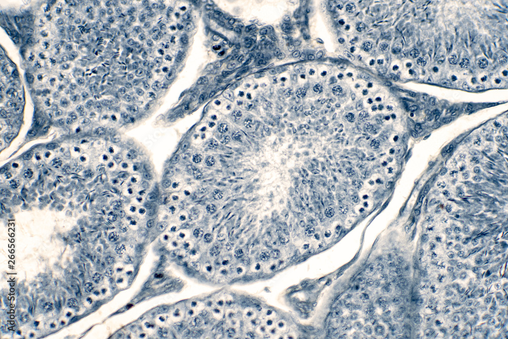 Foto de Stock Cross section Human testis under microscope view. | Adobe ...