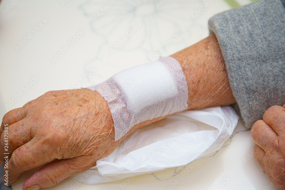 Stock-Foto „Close up old woman wrinkled skin hand or arm to the wounded ...