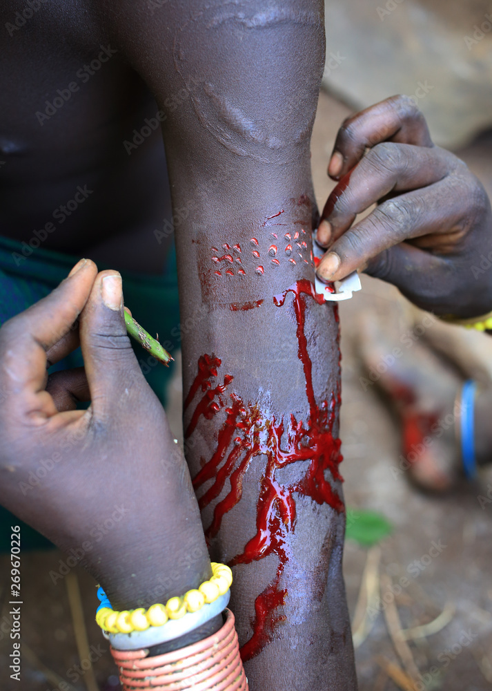 Scarification with razor blade, Suri tribe, Lower Omo Valley, Ethiopia ...