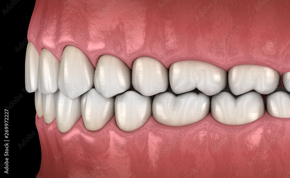 Healthy human teeth with normal occlusion, side view. Medically ...