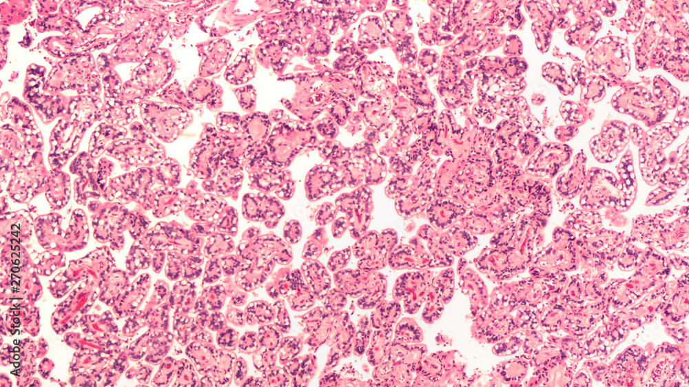 Photomicrograph (microscopic photograph) showing histology of a choroid ...