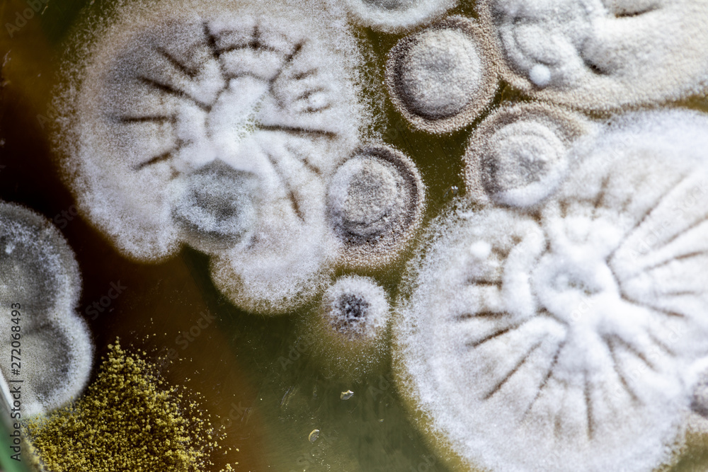 Study Colony characteristic of Actinomyces, Bacteria, yeast and Mold on ...