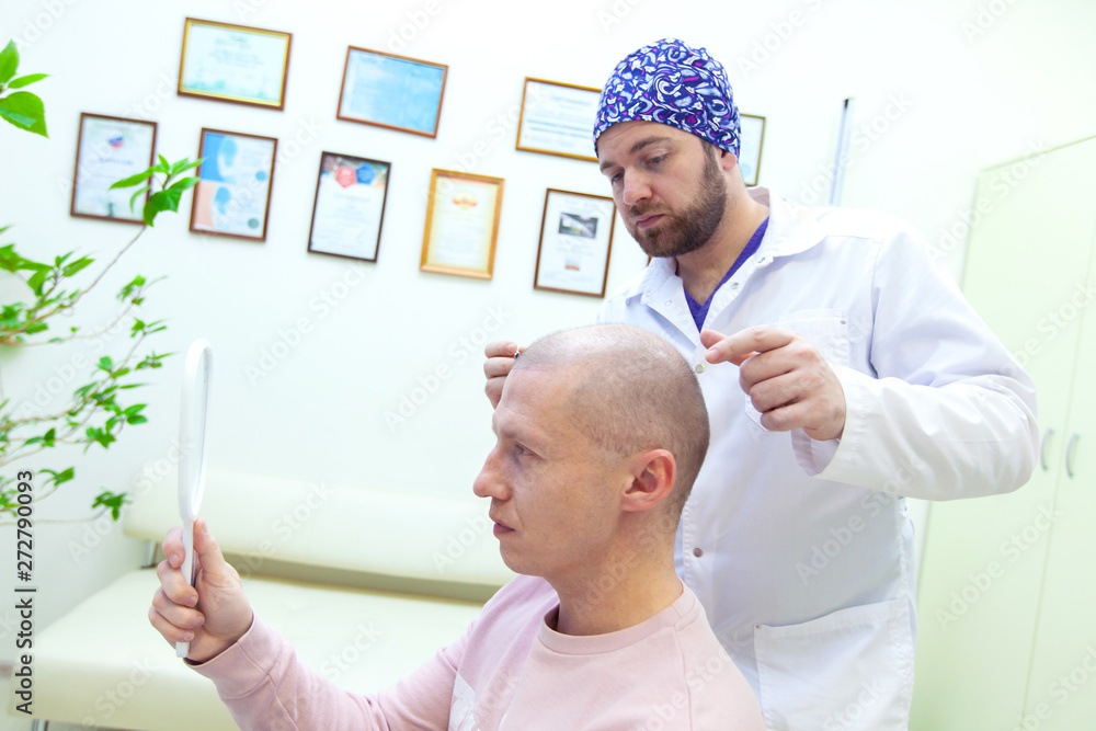 Baldness treatment. Patient suffering from hair loss in consultation ...