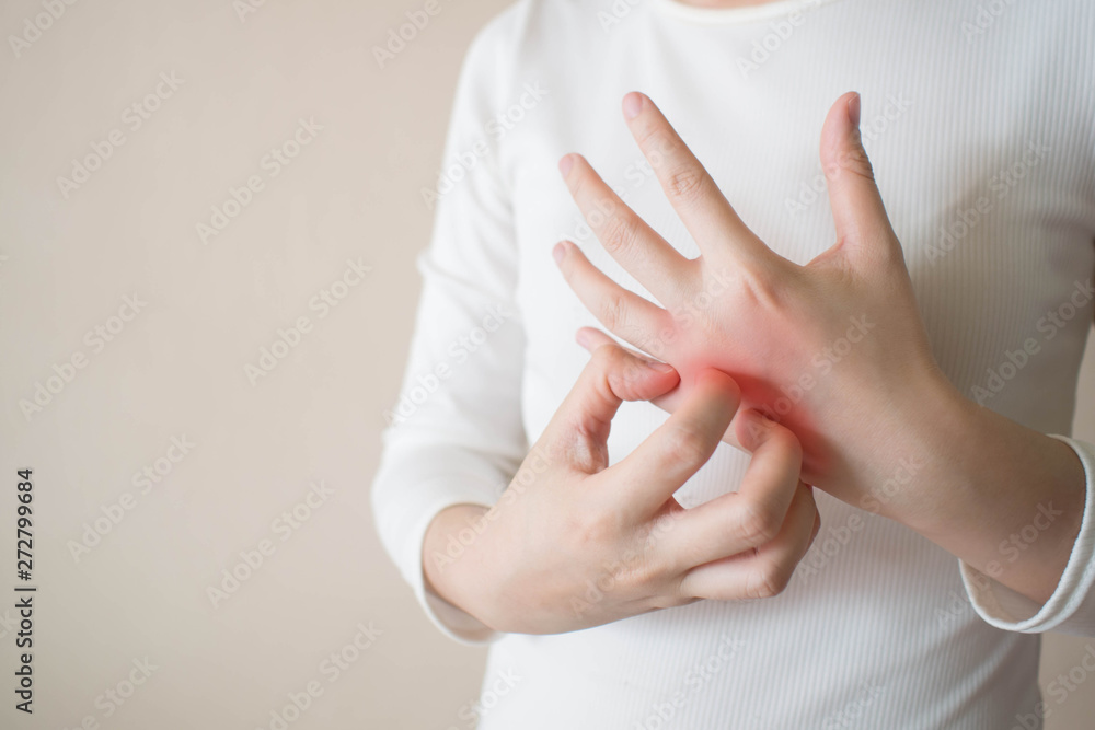 Young woman scratching the itch on her hands w/ redness rash. Cause of ...