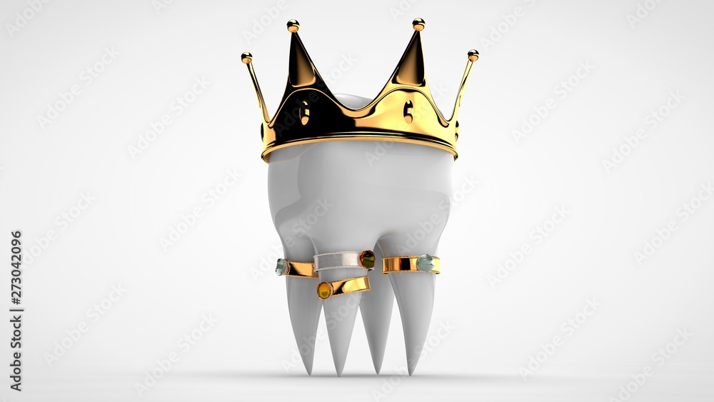 3D rendering of a white human tooth with a gold crown and rings with ...