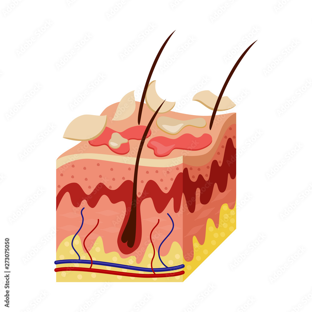 Isolated object of skin and epidermis icon. Collection of skin and ...