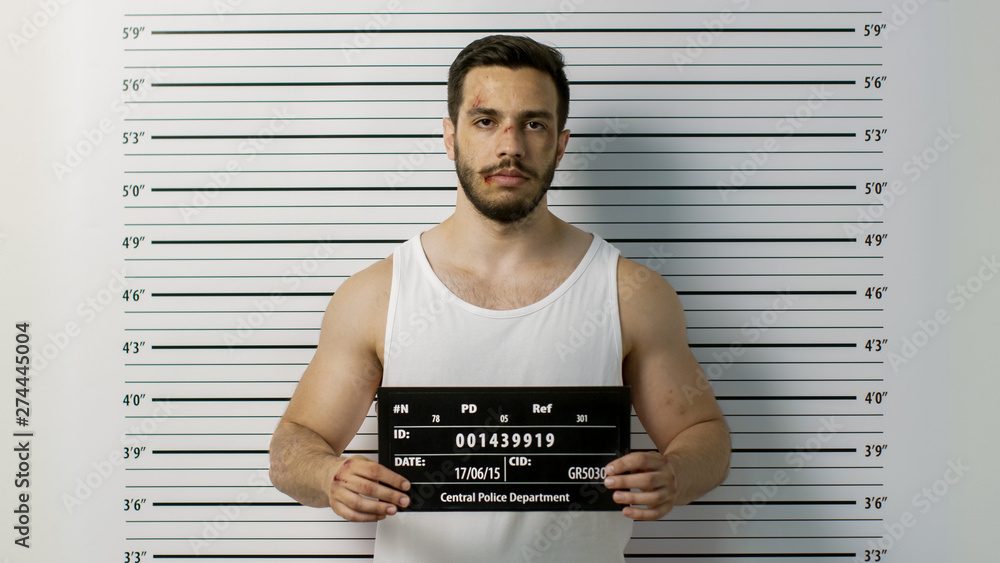 In a Police Station Arrested Beaten Man Poses for Front View Mugshot ...