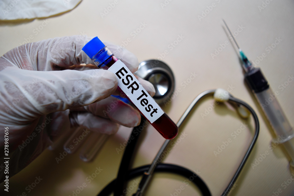 ESR Test text on Sticky Notes. Top view isolated on office desk ...