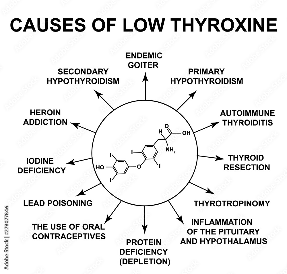 Causes of low thyroxine. Thyroid hormone thyroxine chemical molecular formula. Infographics ...