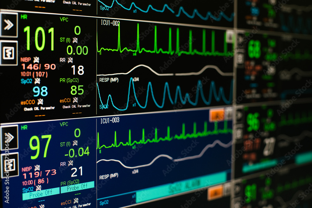 Modern vital signs monitor display at ICU in hospital. Stock Photo ...