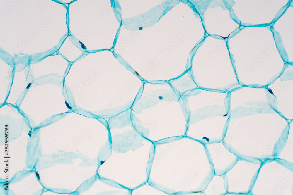 Cross sections of plant stem under microscope view show Structure of ...