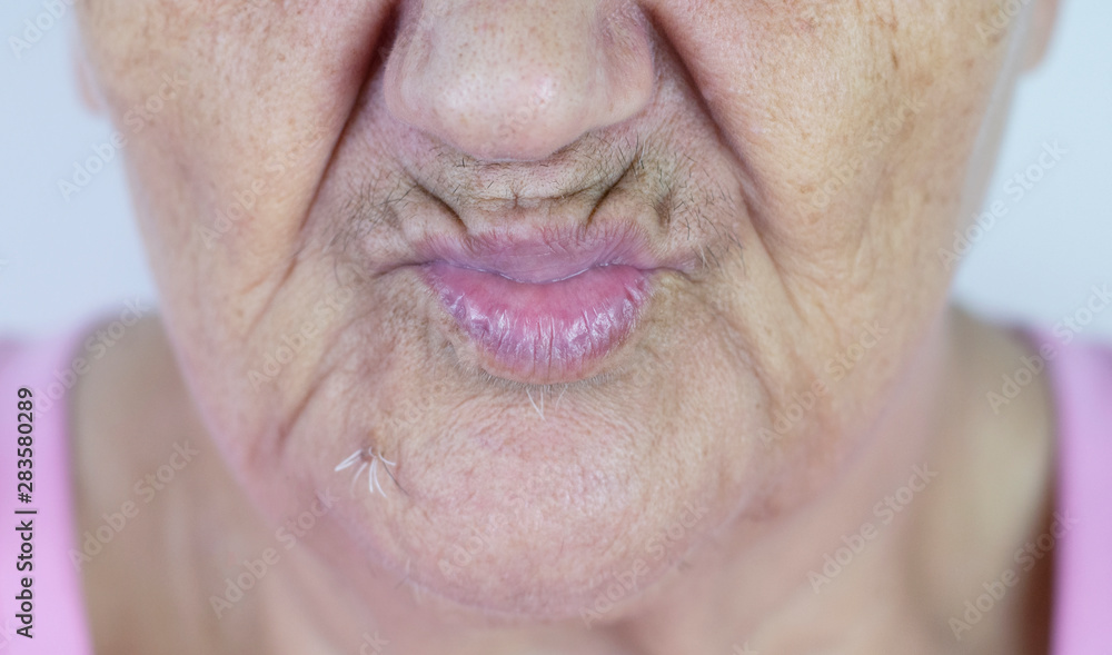 Toothless mouth. An elderly woman with no teeth. Old Granny with her ...