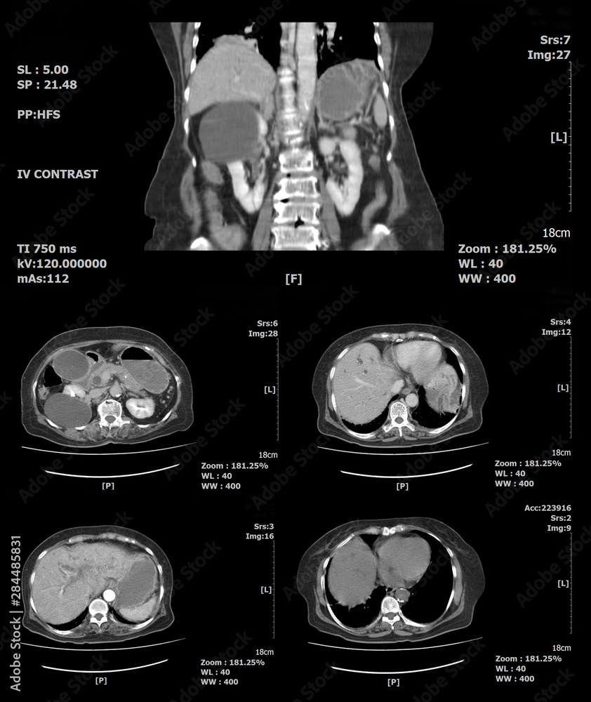ct scan abdomen and body Stock Photo | Adobe Stock