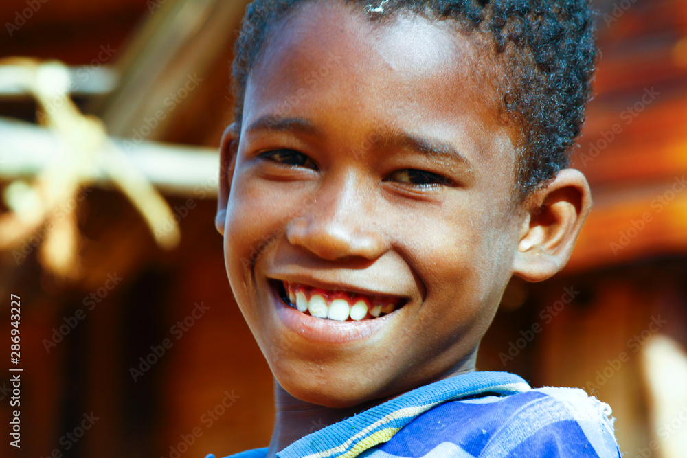 Poor African boy, poverty in Madagascar Stock Photo | Adobe Stock