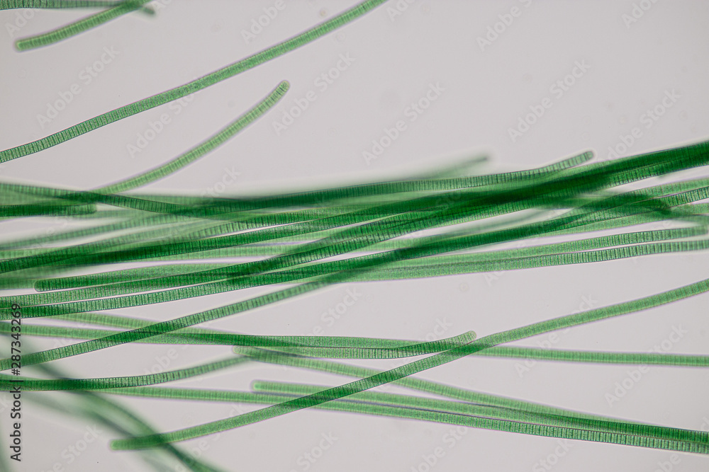 Study of Oscillatoria is a genus of filamentous cyanobacterium ...