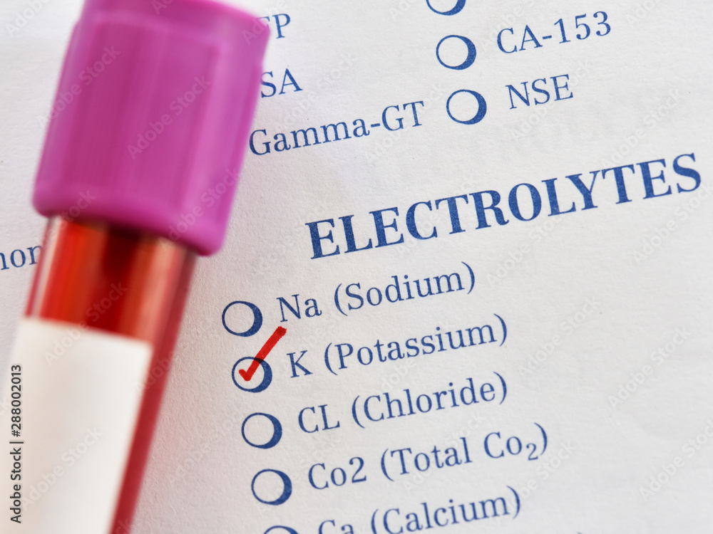 Blood sample tube with laboratory requisition form for potassium test ...