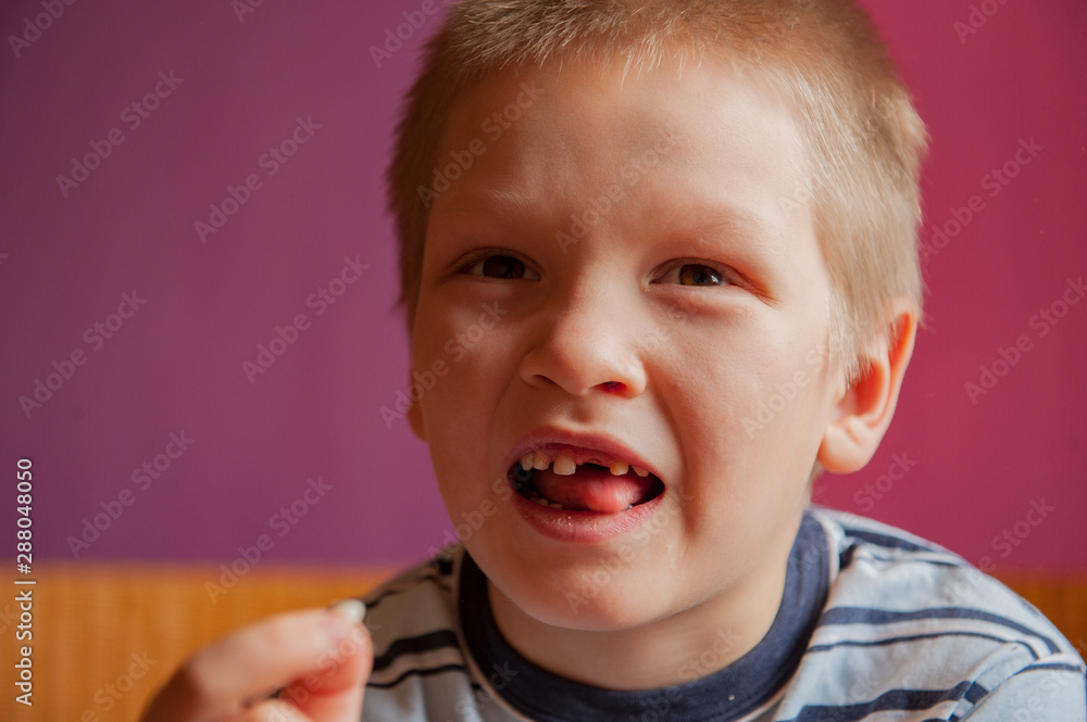 Cute baby shows dropped baby tooth. Boy smiles with toothless mouth ...