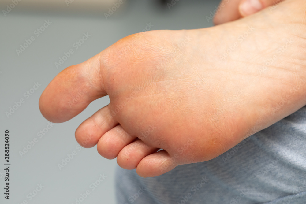 Foto A close-up view on the bottom of a bare caucasian foot, details of ...